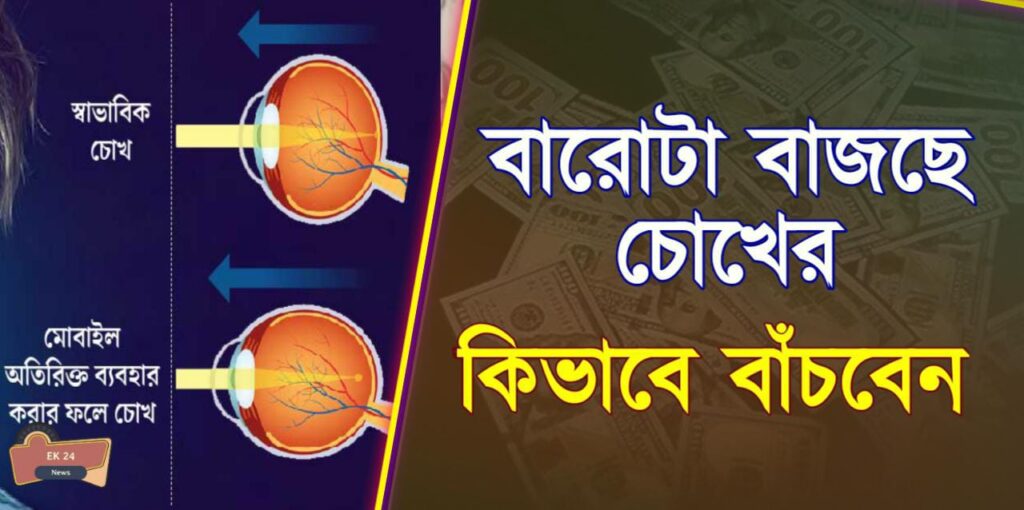 Mobile Side Effects on Eyes - রাত জেগে স্মার্টফোন ব্যাবহার, বদলে যাচ্ছে ...